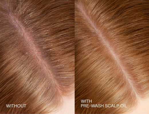 9 Dos and Don’ts for a Healthy Scalp | JVN Hair